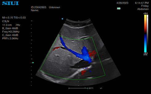 Demystifying Ultrasound Modes: Your Comprehensive Guide – ScanX Ultrasound